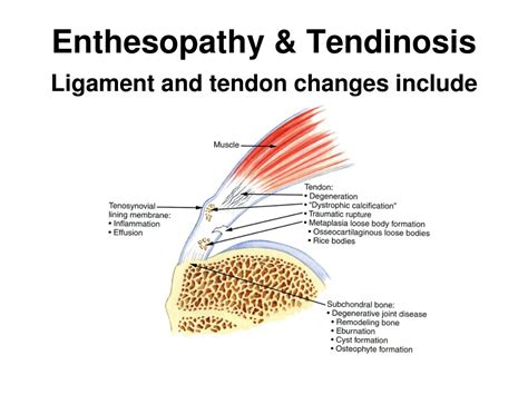 Ppt Conservative Treatment Approaches For Neuromusculoskeletal