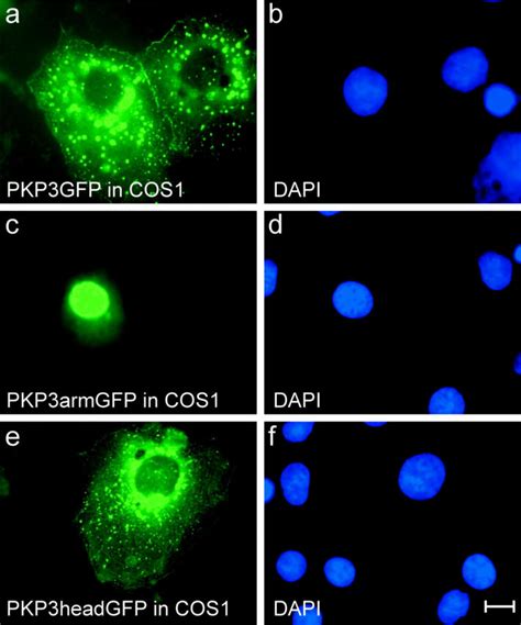Intracellular Localization Of Exogenous Gfp Tagged Pkp3 Fragments In