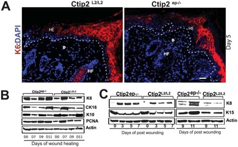 A Ihc Analysis Of K6 Red Expression On Day 5 Post Wounding Samples