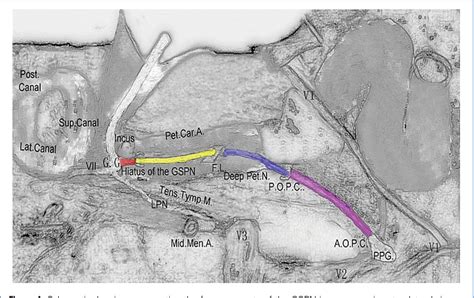 Structure Of Internal Carotid Plexus Semantic Scholar