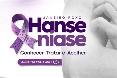 Prefeitura de Eunápolis adere à campanha Janeiro Roxo na luta contra a