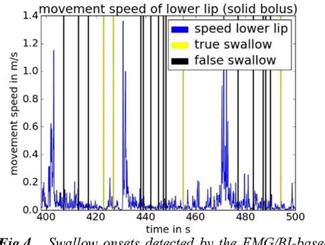 Figure 1 From Multisensor Classification System For Triggering Fes In