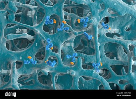Monoclonal Antibody Therapy In Osteoporosis Isometric View 3d