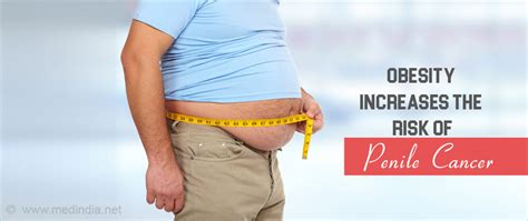 Obesity Increases Risk Of Invasive Penile Cancer