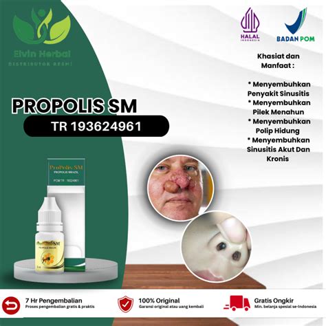 Obat Sinusitis Pilek Menahun Alergi Hidung Gurah Hidung Polip Hidung Anosmia Hidung Bau Busuk