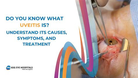 What Uveitis Is Understand Its Causes Symptoms And Treatment Asg