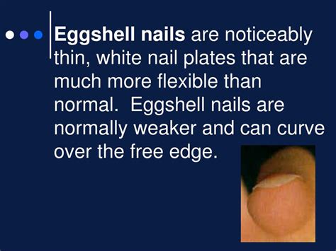 Ppt Nail Disorders Powerpoint Presentation Free Download Id2647524