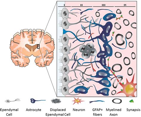 Human Subventricular Zone Hsvz On The Right A Coronal Section Of