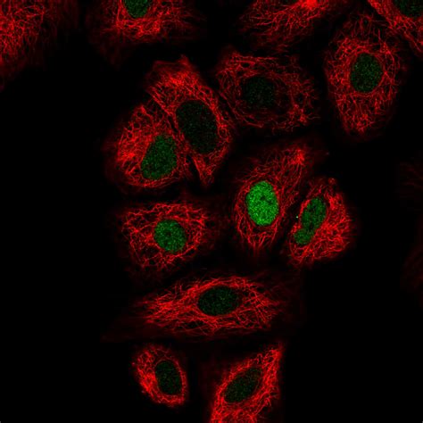 Subcellular Tp53 The Human Protein Atlas