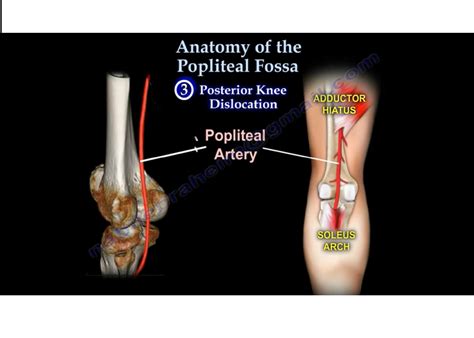 Popliteal Fossa Anatomy