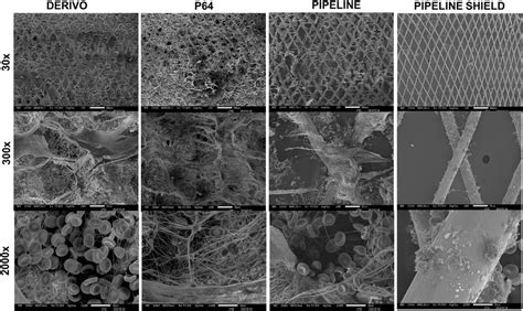 High Resolution Scanning Electron Microscopy Sem Representative