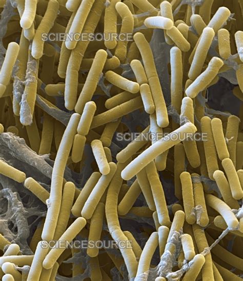 Clostridium Botulinum Sem Stock Image Science Source Images