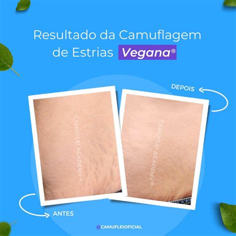 Camuflagem De Estrias Moema