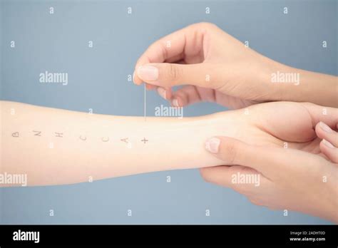 Model Released Allergy Test Arm Of A Twenty Five Year Old Woman