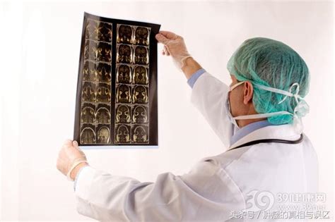 放療會讓人死得更快？醫生是這麼回答的 每日頭條