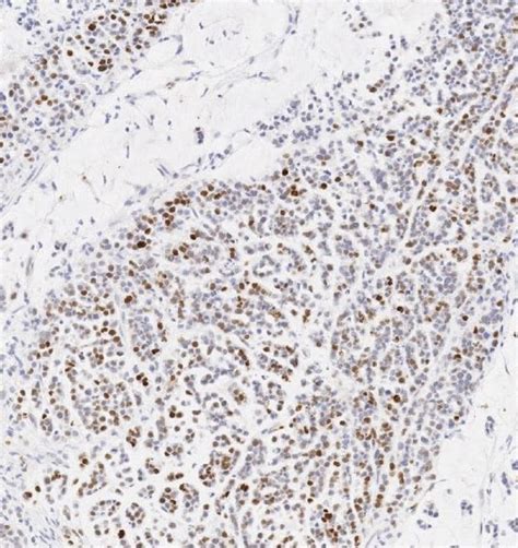 Recombinant Anti P53 Antibody Sp5 Ko Tested Ab16665 Abcam