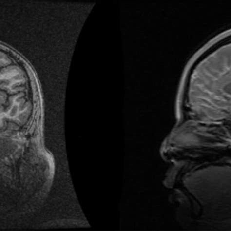 Cranial Magnetic Resonance Abnormal Pituitary Download Scientific