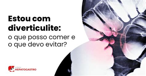 Estou Com Diverticulite O Que Posso Comer E O Que Devo Evitar