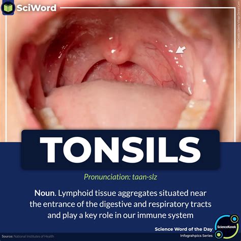 Sciencekonek Sciword 𝗬𝗘𝗦 𝗪𝗘 𝗔𝗟𝗪𝗔𝗬𝗦 𝗛𝗔𝗩𝗘 𝗧𝗢𝗡𝗦𝗜𝗟𝗦 👄 Ever Hear Someone Say “i Have Tonsils