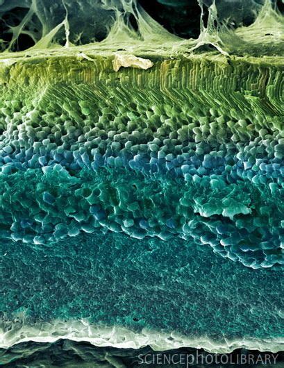 Coloured Freeze Fracture Scanning Electron Micrograph Sem Of The