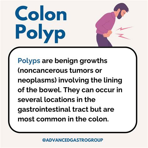 Advanced Gastroenterology Group Polyps Are Noncancerous Growths That