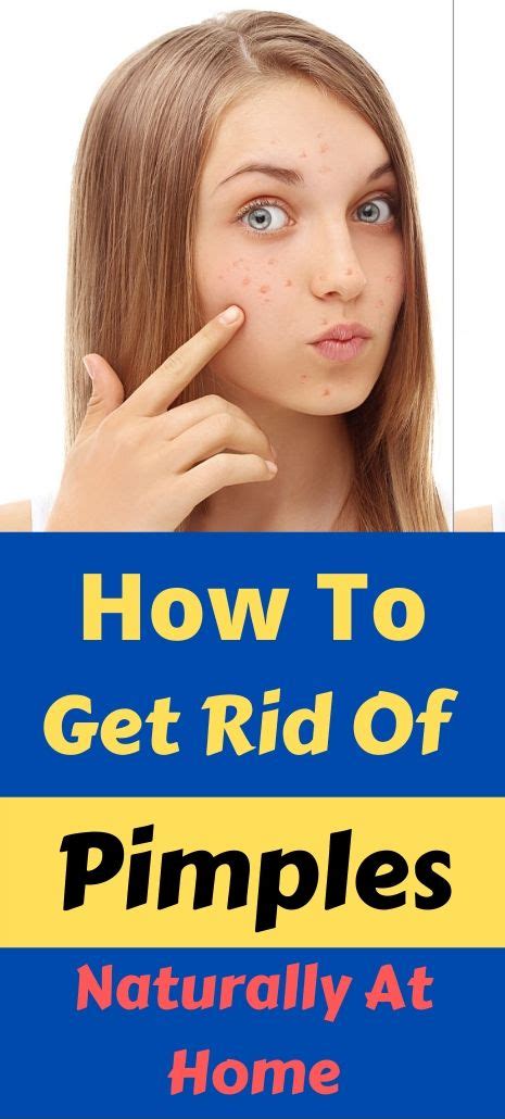 How To Get Rid Of Pimples Naturally Overnight Fast SKINCARE