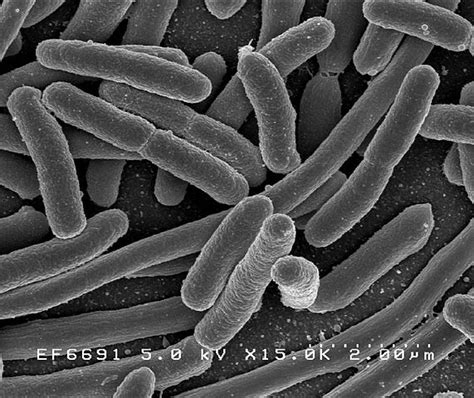 Página De Curiosidades Y Más ¿qué Es La Bacteriología