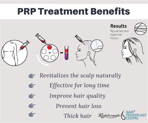 Prp Treatment Benefits Read Rejuvenate Hair Transplant Facebook