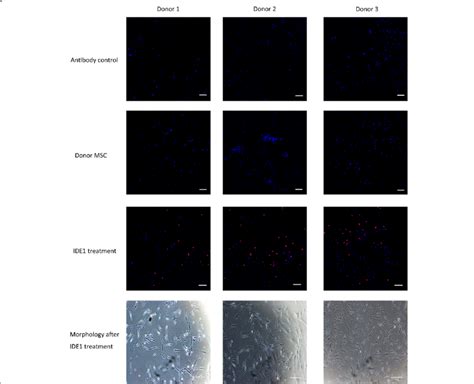 Sox 17 Expression On Bone Marrow Derived Mesenchymal Stem Cells After