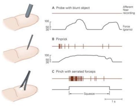 Analgesics Flashcards Quizlet