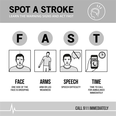 응급처치 완전정복 12 뇌졸중과 두통의 관계 그리고 Fast — Steemit