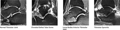 The Ankle And Foot Musculoskeletal Key