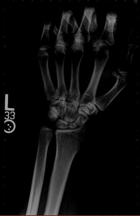 Guidelines For Image Evaluation Digital Radiographic Exposure Principles And Practice