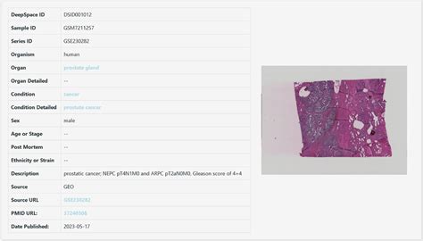 Deepspacedb A Spatial Transcriptomics Database Is Released Nbdc Deepspacedb A Spatial Transcriptomics Database Is Released Nbdc