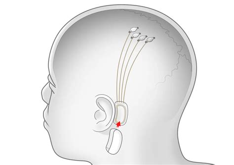 Musk Neuralink Will Reach Human Testing By Mid 2023 The Healthcare Technology Report Musk Neuralink Will Reach Human Testing By Mid 2023 The Healthcare Technology Report