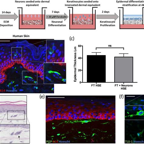 Incorporation Of Sensory Neurons Into Full‐thickness Skin Equivalent