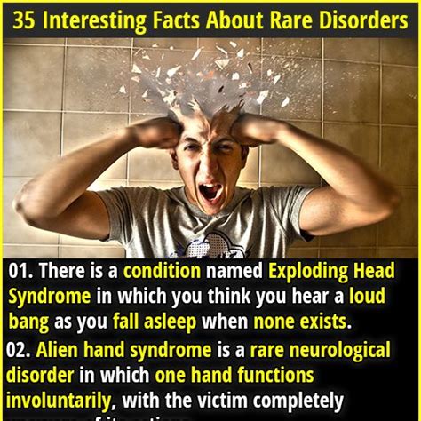 Exploding Head Syndrome Artofit