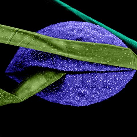 Scanning Electron Microscope Sem Image Of Mold Colorized With