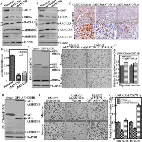 Atg7 Was An Mir190a Downstream Effector Responsible For Bc Invasion