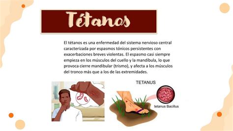 Tétanos Doctor teco uDocz
