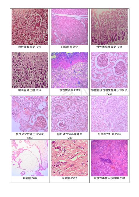 病理学实验 切片 哔哩哔哩