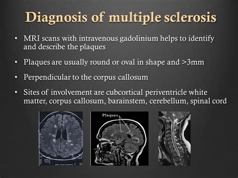 Multiple Sclerosis Diagnosis Age Multiple Sclerosis Symptoms And