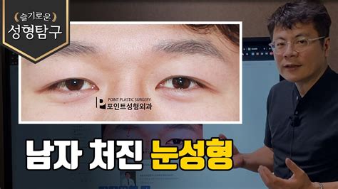 처진남자눈성형 눈썹아래절개 Vs 비절개쌍꺼풀수술 Youtube