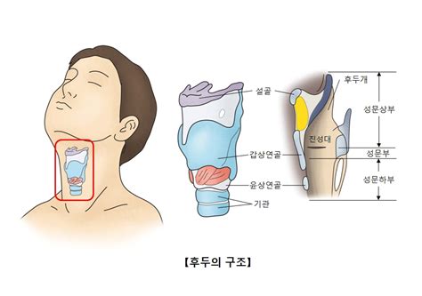 후두암 초기증상 및 생존율