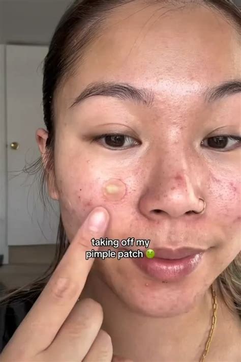 Peace Out Skincare Acne Day And Night Duo 6 Hour Fast Acting Sheer