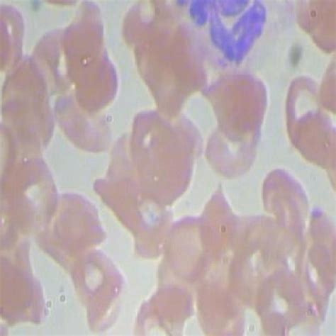Data Valid Blood Cell Dataset 3 Object Detection Dataset By Nihars