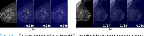 Figure 11 From An Interpretable And Accurate Deep Learning Diagnosis