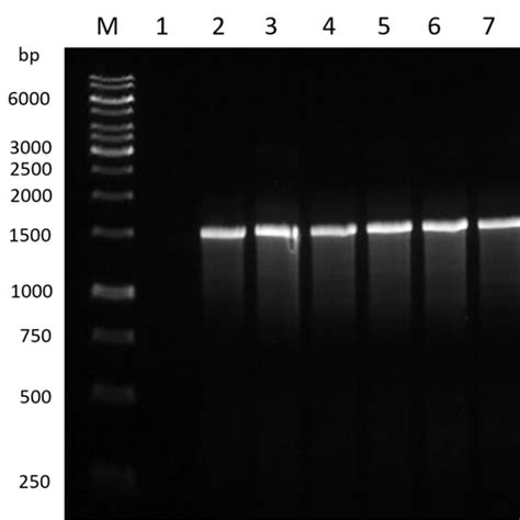 Pcr Amplification Products Of The 16s Rrna Gene Marker For Bacillus