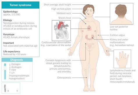 Androgen Insensitivity Syndrome Genitalia