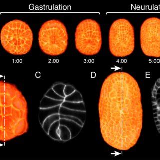 High Resolution Multiview Lightsheet Live Imaging Of Phallusia